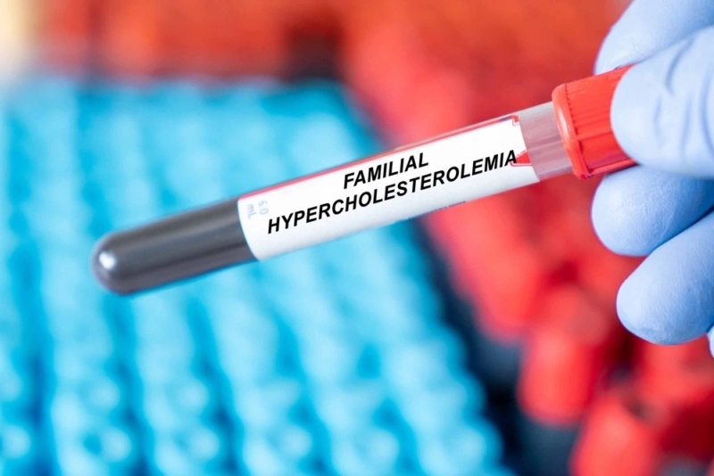 Familial Hypercholesterolemia | News | Allevia Cardiology Ascot